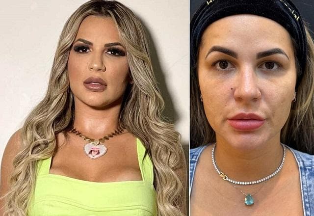 Deolane Bezerra Surpreende Com Antes E Depois Impressionante Sbt Tv